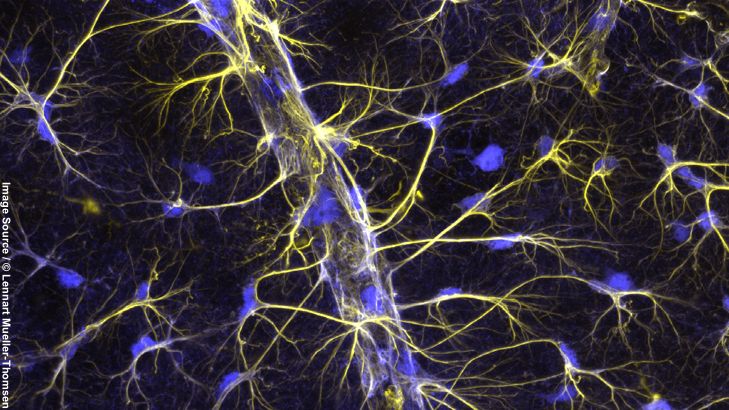 Astrozyten: Sternenförmige Gliazellen sind heimliche Stars des Gehirns