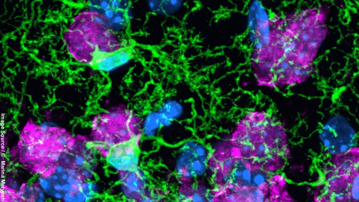 Gliazellen: Kitt der Nervenzellen, "Stille Post-Zellkommunikation ...