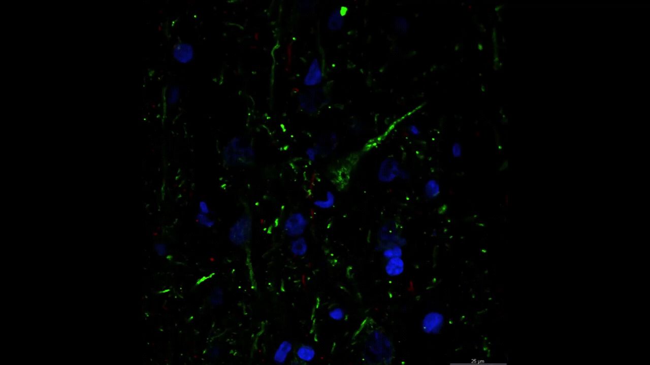 Anatomie: Der Cortex, die Graue Substanz