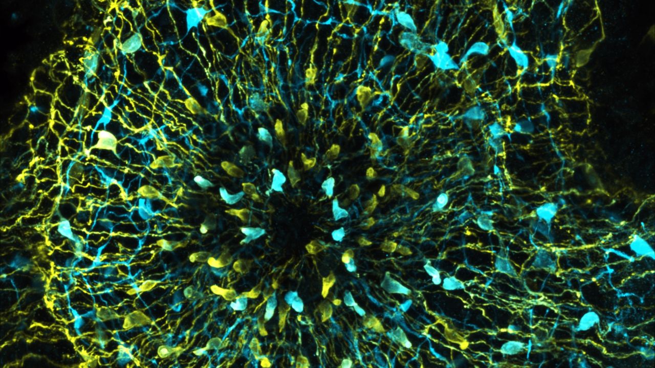 Das Gehirn hat immer Hunger