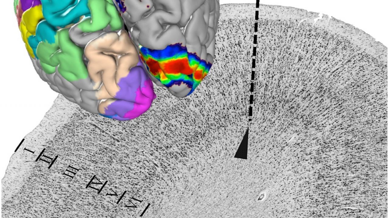 Visuelle Informationsverarbeitung - vom Auge zum Gehirn (Cortex)