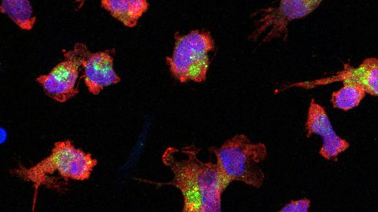 Mikroglia: Die mobilen und wachsamen Zellen im Gehirn